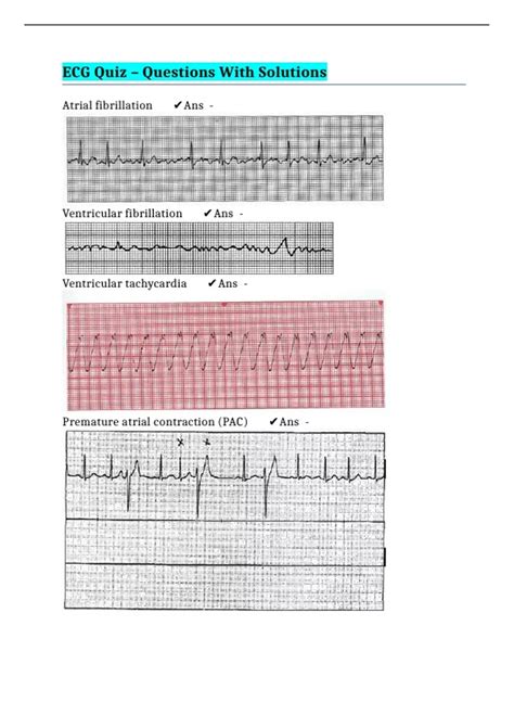Ecg Quiz Questions With Solutions Ecg Stuvia Us