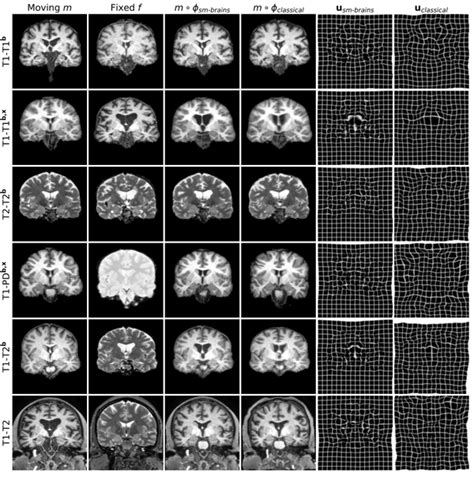 分割图——synthmorph，零样本学习完成跨模态配准任务 知乎