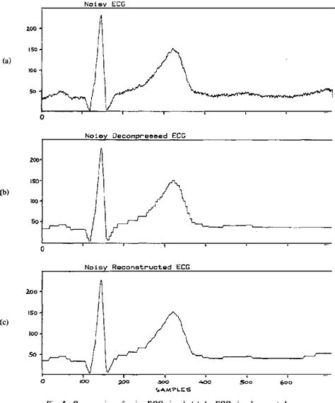 Figure 5 From An Adaptive Real Time Ecg Compression Algorithm With Variable Threshold Semantic