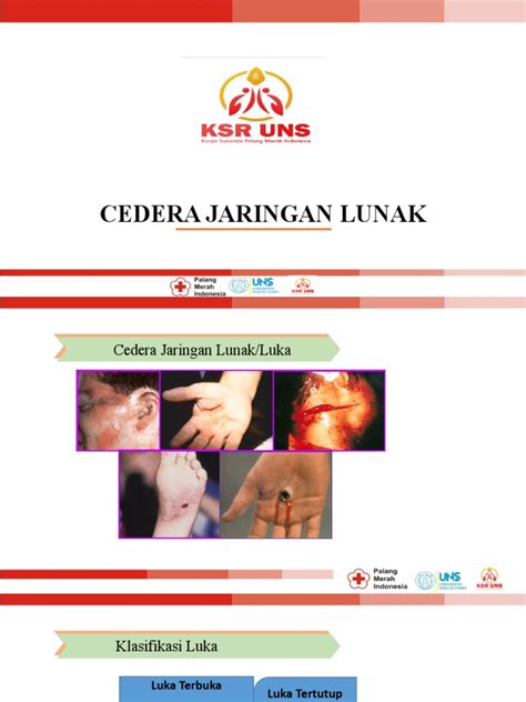Pp Cjl Cedera Jaringan Lunak Pdf