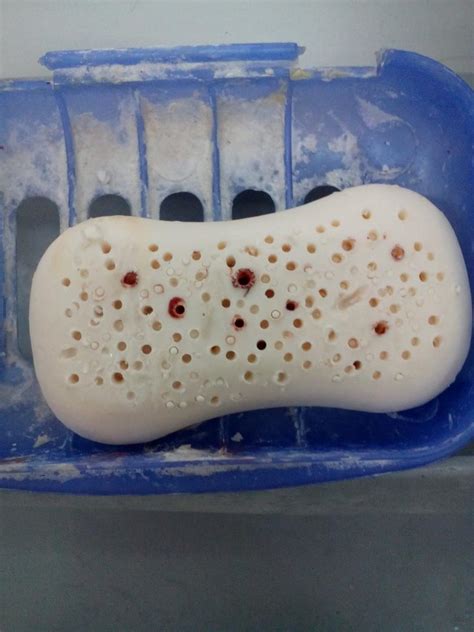 Trypophobia Is An Absolutely Terrifying Thing And You Definitely Have It
