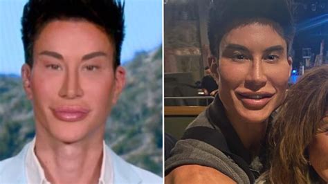 Justin Jedlica Antes E Depois Human Ken Doll Reveals Reason Behind