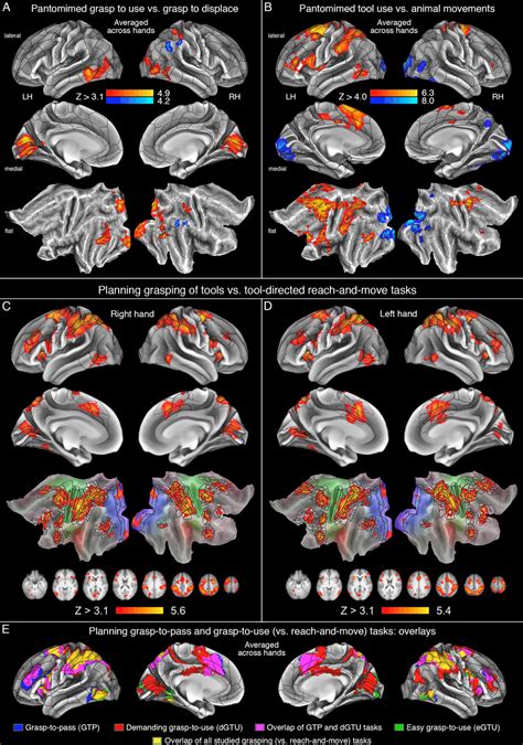 Brain Areas Showing Significant Increases Of Neural Activity During