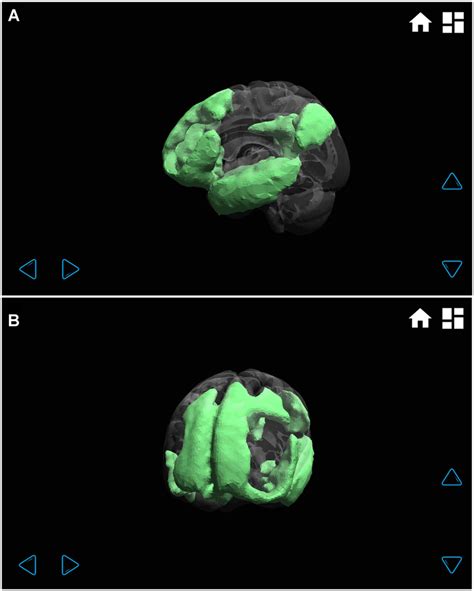 Default Mode Functional Connectivity Network Displayed At Different Download Scientific Diagram