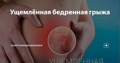 Ущемлённая бедренная грыжа Смарт Клиника Воронеж Дзен