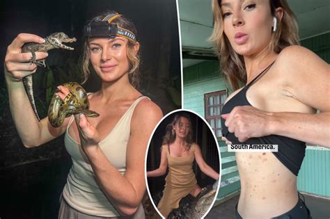 ‘worlds Hottest Scientist Rosie Moore Diagnosed With ‘deadly Disease
