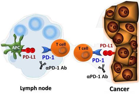 Immunotherapy Expands Lung Cancer Treatment Options Nci