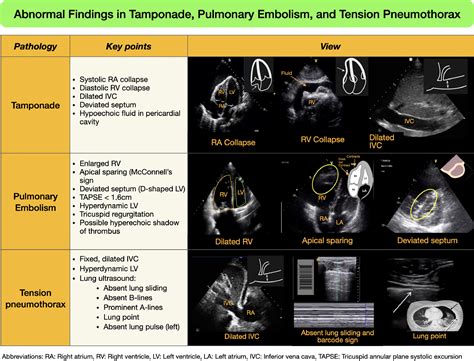 Simplified Algorithm For Evaluation Of Perioperative Hypoxia And