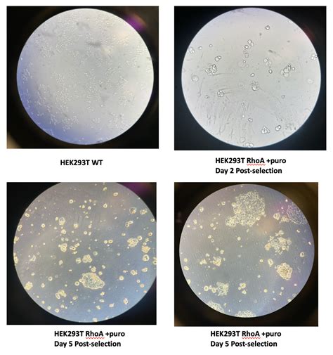 200 Questions With Answers In Puromycin Science Topic