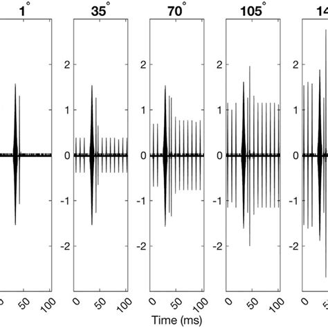 Ms RF Signal Segments From Sequence A Performed With Different Flip Download Scientific