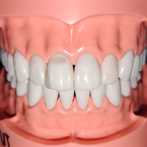 Things That Prevented Me From Playing Genshin HoYoLAB