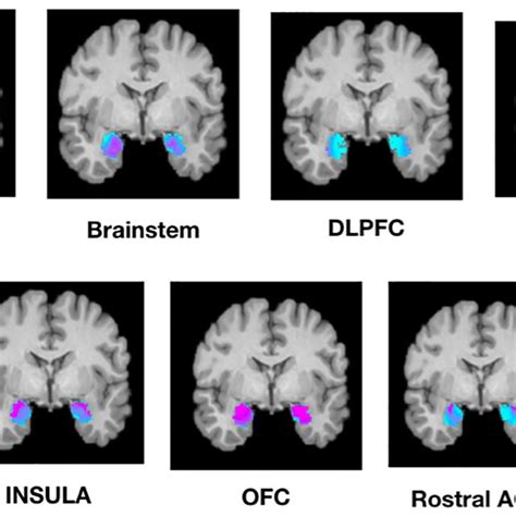 Population Maps Of Amygdala Connectivity To Each Target Structure The Download Scientific