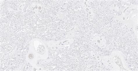 Strange Ihc Staining R Labrats