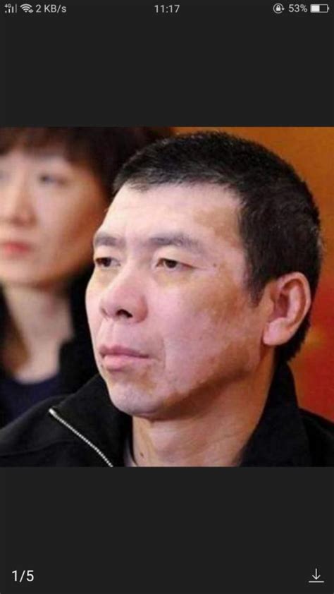 61岁冯小刚“白癜风”恶化身价过亿的他为何不治徐帆终于道出真相冯小刚白癜风徐帆新浪新闻