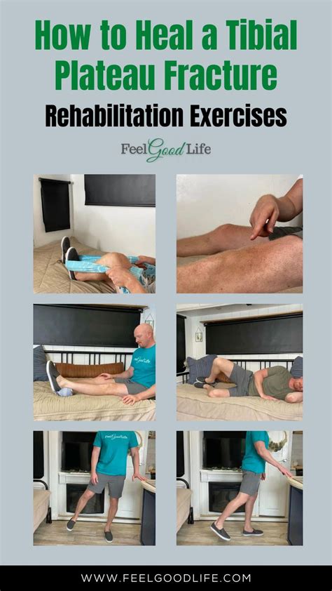How To Heal A Tibial Plateau Fracture Rehabilitation Exercises