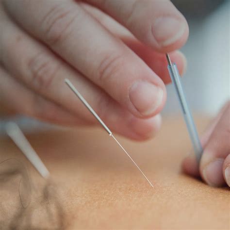 Easing Side Effects Acupuncture And Cancer Treatment Everviolet