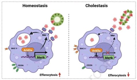 J Hepatol 上海交通大学马雄 唐茹琦等发现胆汁淤积性肝病的潜在治疗靶点！ 健康160