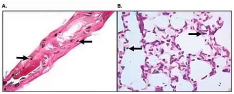 Dna Fragmentation In Apoptosis Detection And Tunel Assays Bio Techne
