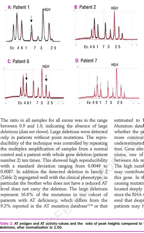 Dhplc Chromatograms Of Four At Deficient Patients With Partial And