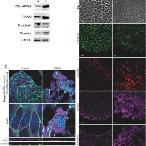Knockdown Of Runx1 Inhibits The Tgfb Signaling Pathway Specifically