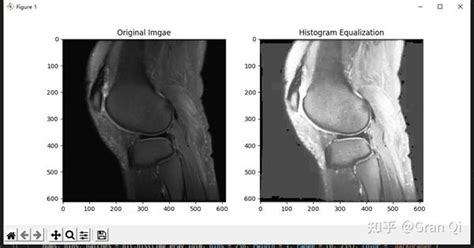 直方图均衡化（histogram equalization） 知乎