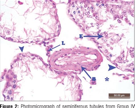 Figure 1 From The Effect Of Selenium Nanoparticles Versus Royal Jelly Against Cisplatin Induced