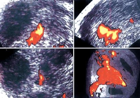simultaneous rendering of all three orthogonal sectional planes