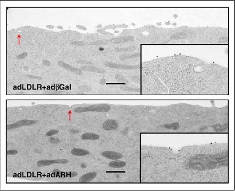 Figure 5 From The Modular Adaptor Protein Autosomal Recessive Hypercholesterolemia Arh
