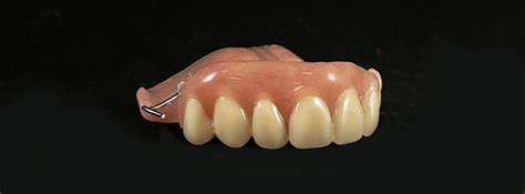 Acrylic Partial Dentures