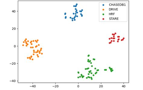 T Sne Visualization Of Vgg16 Features Of Fundus Images Acquired By Download Scientific Diagram