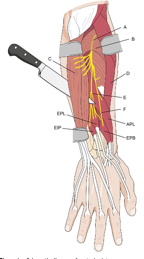 Synovial Tendon Sheath Of Extensor Digitorum And Extensor Indicis Semantic Scholar