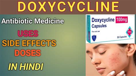 Doxycycline Capsules 100mg For Acne Doxycycline Side Effects Use Dose In Hindi YouTube