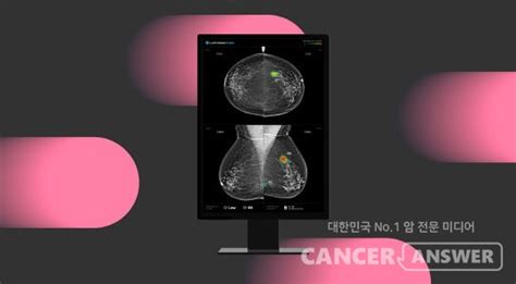 유방암 검진 인공지능 Ai 활용시 암 발견 가능성 높다