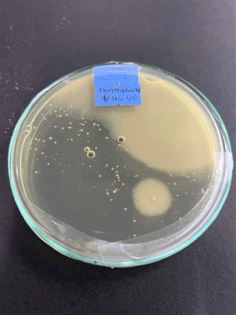 Having Trouble With Contamination In My Plates Any Advice R Microbiology