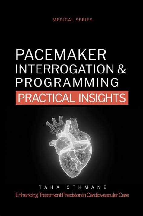 Pacemaker Interrogation And Programming Practical Insights Medical