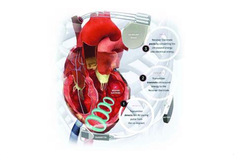 Components Of The Wise Crt System Reproduced From Reference 64