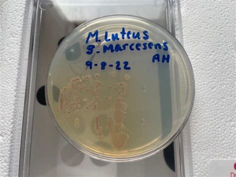 How Many Colonies Are On This Agar Plate Can Someone Chegg Com
