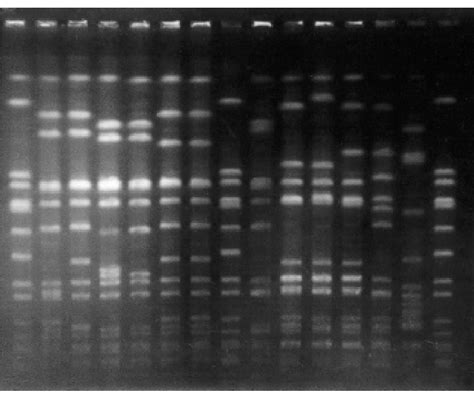 Pfge Pattern Of Mrsa Isolates The Various Pfge Patterns On The Gel Are Download Scientific
