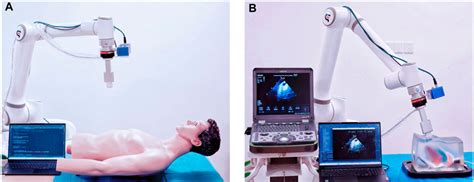 Frontiers Autonomous Ultrasound Scanning Robotic System Based On Human Posture Recognition And