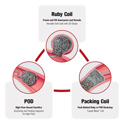 Peripheral Embolisation Penumbra Inc