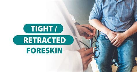 Tight Foreskin And Retracted Foreskin Circumcision Malaysia