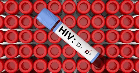 Hiv Testing Confidentiality And Privacy Concerns Hiv Testing Confidentiality And Privacy Concerns