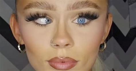 Model Trolled For Lazy Eye Transforms After Undergoing Corrective Surgery Daily Star Model Trolled For Lazy Eye Transforms After Undergoing Corrective Surgery Daily Star