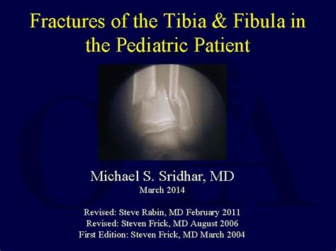 Fractures Of The Tibia Fibula In The Pediatric