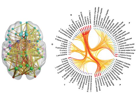 The Common Role Of The Intraparietal Sulcus In Mental Rotation And Antisaccades Monash