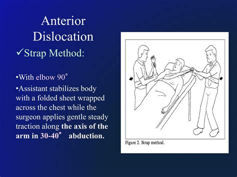 Ppt Shoulder Dislocation Powerpoint Presentation Free Download Id 4841498