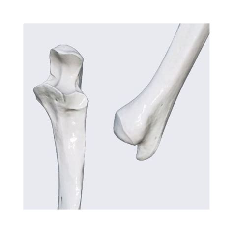 Proximal And Distal Ulna Diagram Quizlet