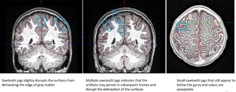 Post Processing Quality Assessment From Executive Summary Dcan Labs