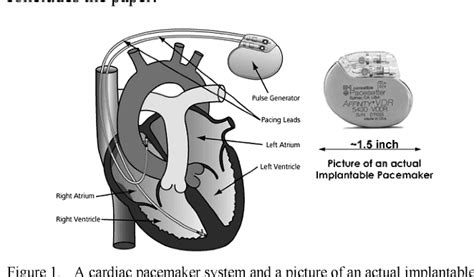 Figure 2 From Power Gating Technique In Pacemaker Design On Fpga Semantic Scholar