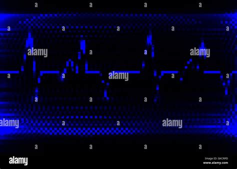 Colorful Human Heart Normal Sinus Rhythm Electrocardiogram Record